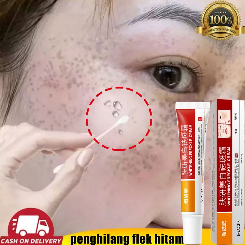 whitening freckle remover cream Whitening freckle cream 美白祛斑霜 30g ...