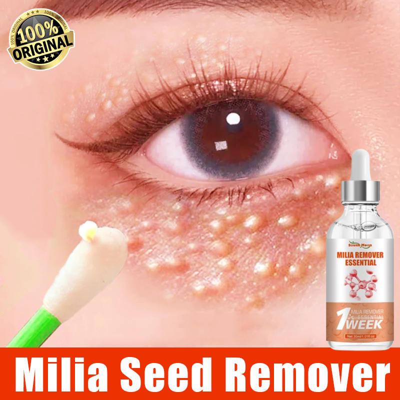 Milia Seed Remover Fat Granule Syringoma Milia Remover Grease Grains ...