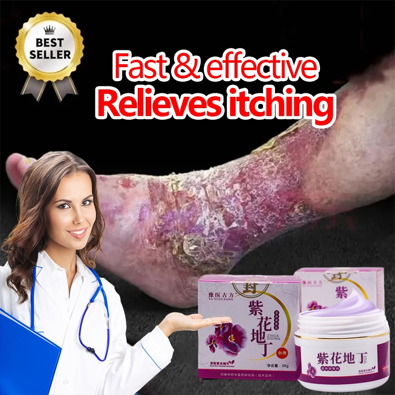 Itching cream Eczema cream 20g antifungal cream private parts anti-itch allergy and redness fast ...
