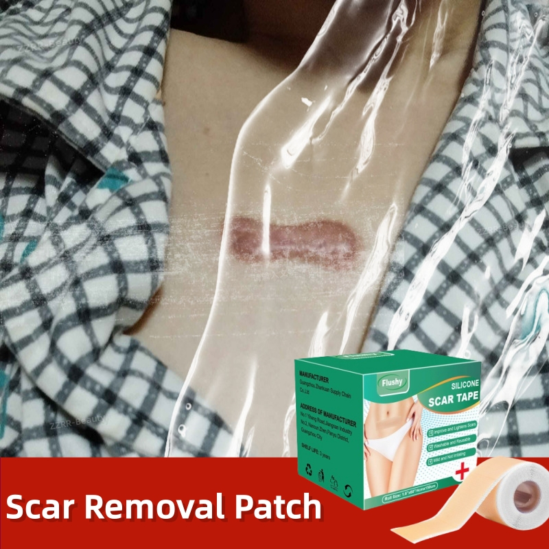 Scar Removal Patch 4*150cm hilangkan parut hitam menghilangkan bekas ...