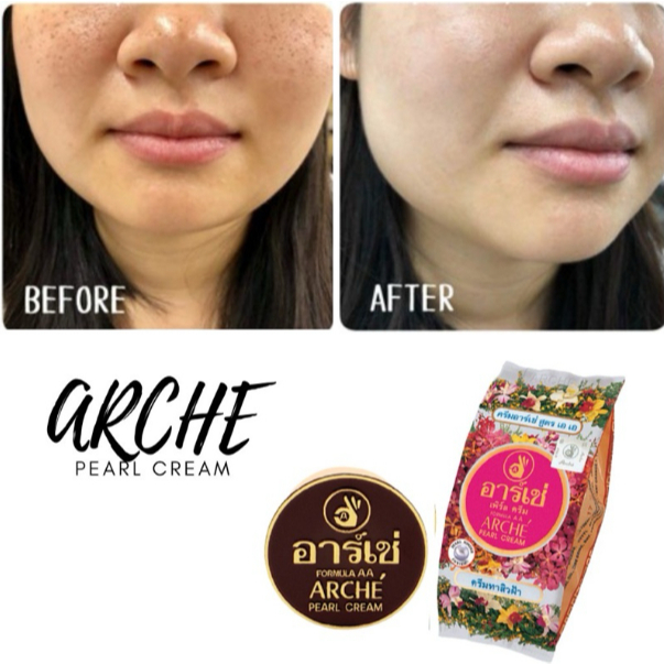 ARCHE Cream (Pure Pearl Whitening) 100% Original From Thailand | Shopee ...