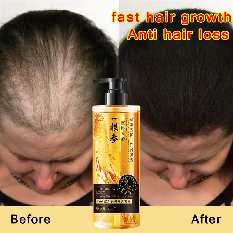 Hair growth shampoo Hair Tonic anti hair loss shampoo 300ml ginseng shampoo Oil control and ...