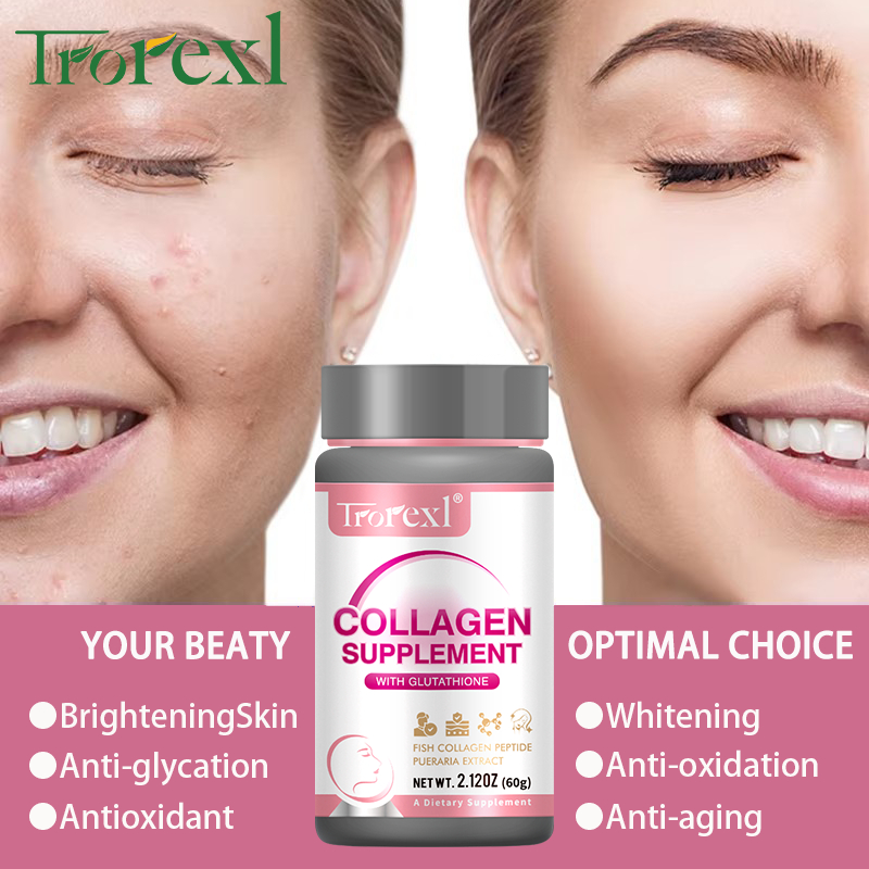 Trorexl Glutathione Tablet Collagen Supplement Glossiness Whitening ...