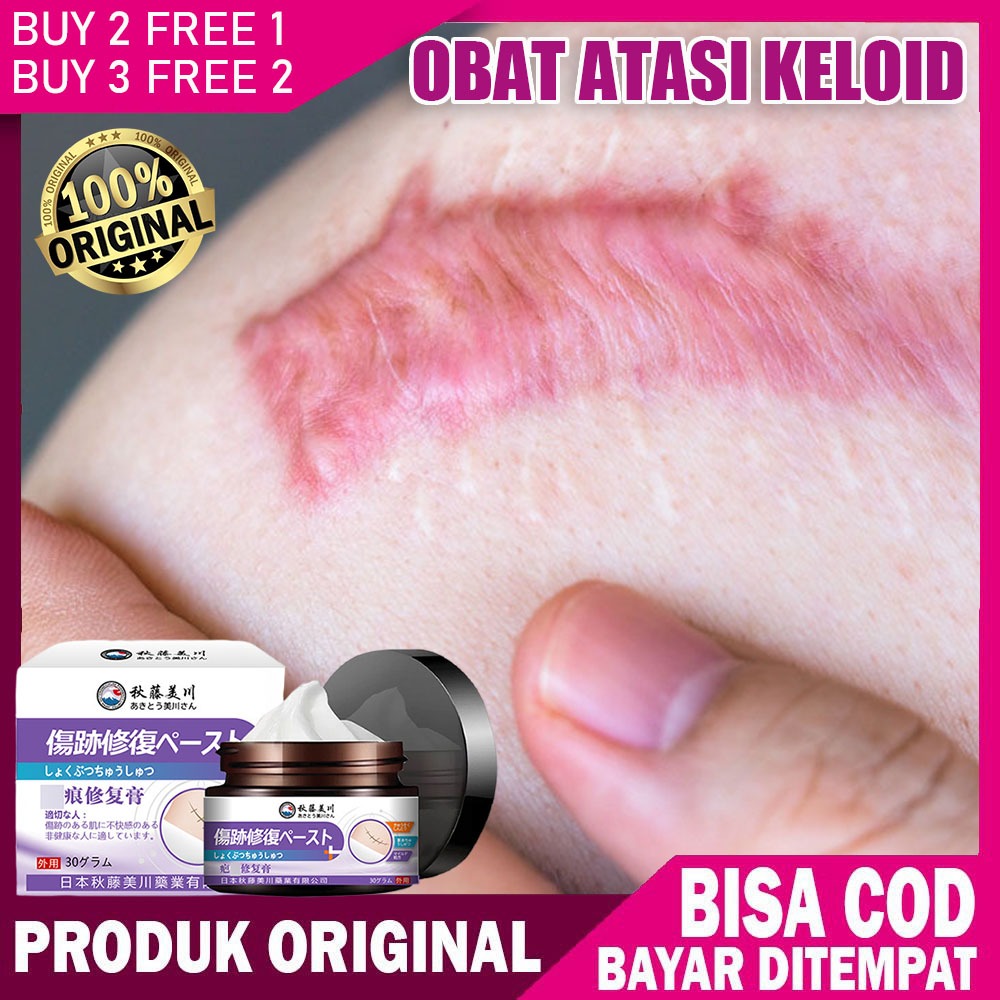 keloid scar remover krim hilangkan parut hitam acne scar removal cream ...