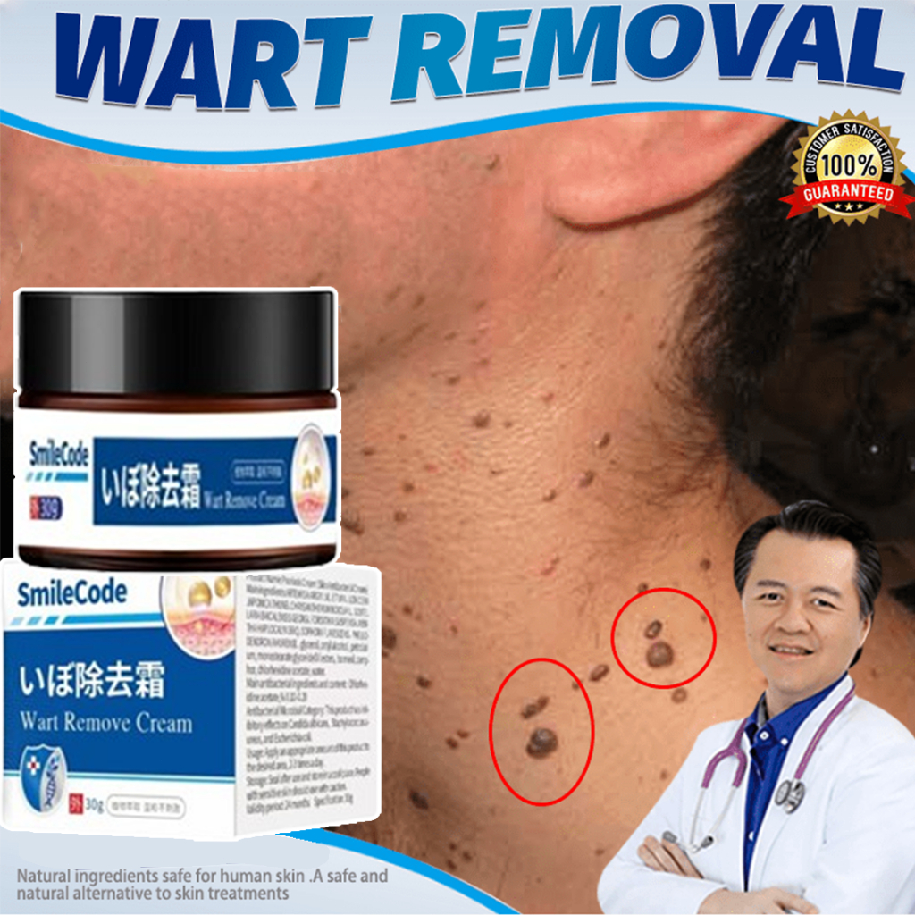 Ubat ketuat warts removal cream 30g wart remover skin tag remover ubat ...