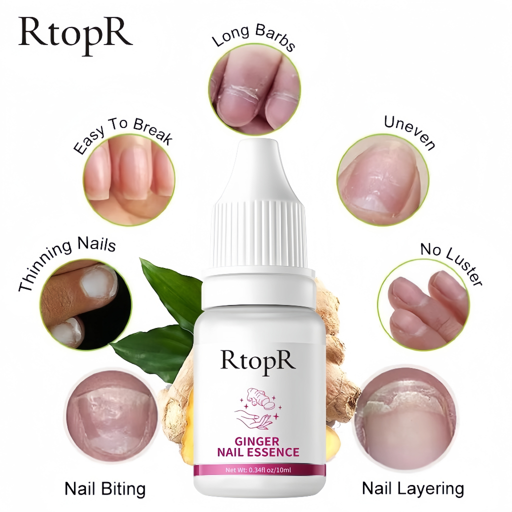 RtopR Ginger Antibacterial Nail Treatment Anti Onychomycosis Paronychia ...