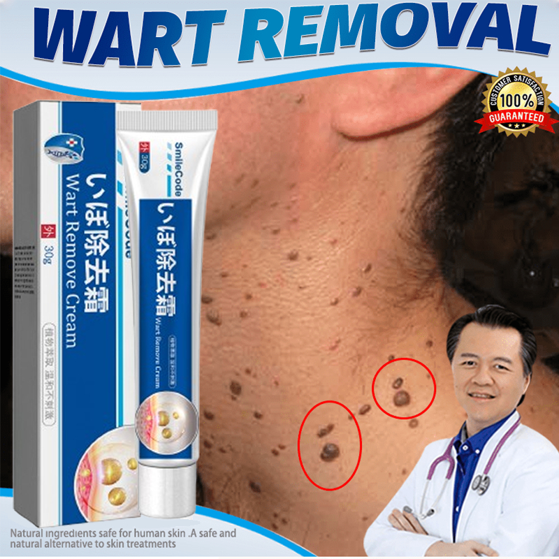 🔥Same-day shipping🔥 ubat ketuat wart remover mole skin tag remover ubat ...