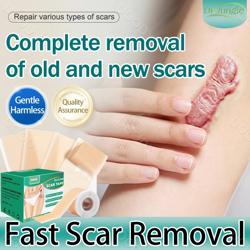 silicone scar sheet silicone scar tape keloid scar plaster scar removal ...