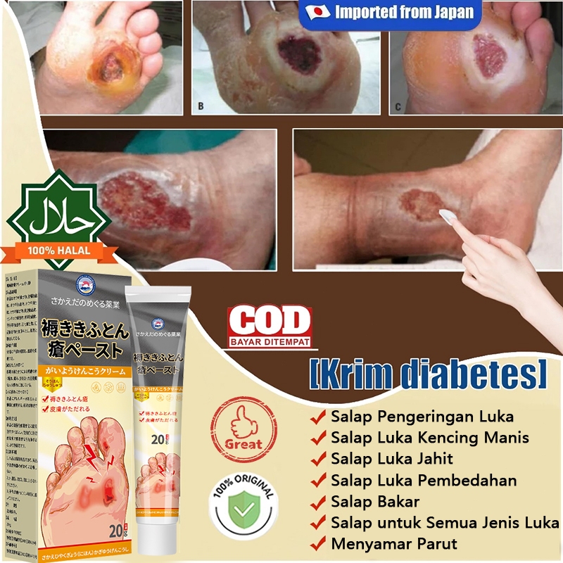Bedsore Treatment Cream Pressure Sore Ulcer Skin Rot Necrotic repair ...