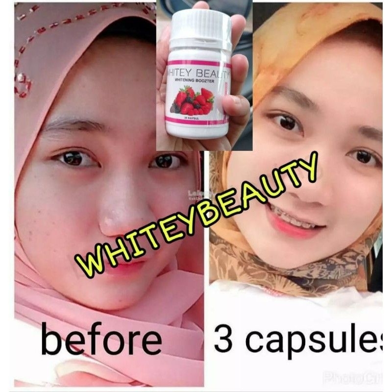 Pencerah Muka, Pemutih Kulit, PIL PUTIH VIT C, GLUTATHIONE BOOSTER ...