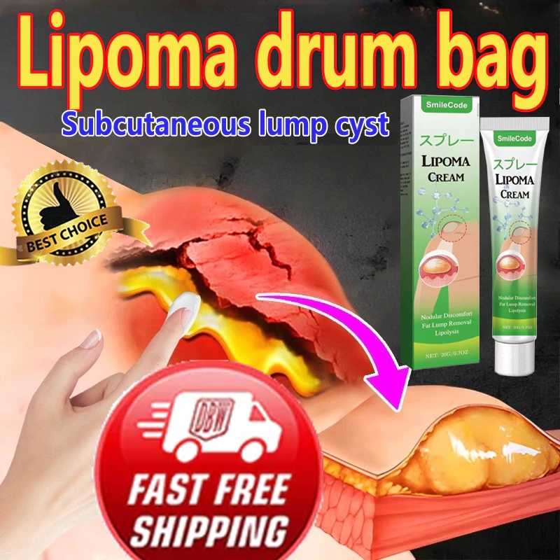 Specializing in lipoma! Lipoma removal cream original 20g Lipoma cream ...