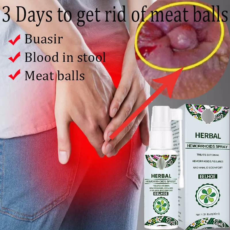 ubat buasir Hemorrhoids spray Hemorrhoid cream ubat buasir bengkak Treatment internal and ...