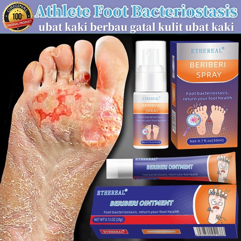 ubat kaki berbau kulat air kaki antibacteria foot spray cream fungus ...