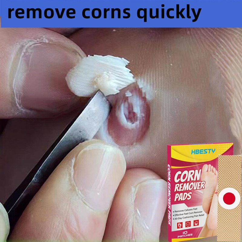 Ubat Ketuat Tapak Kaki Foot Corn Remover Corn Caps corn plaster remover ...