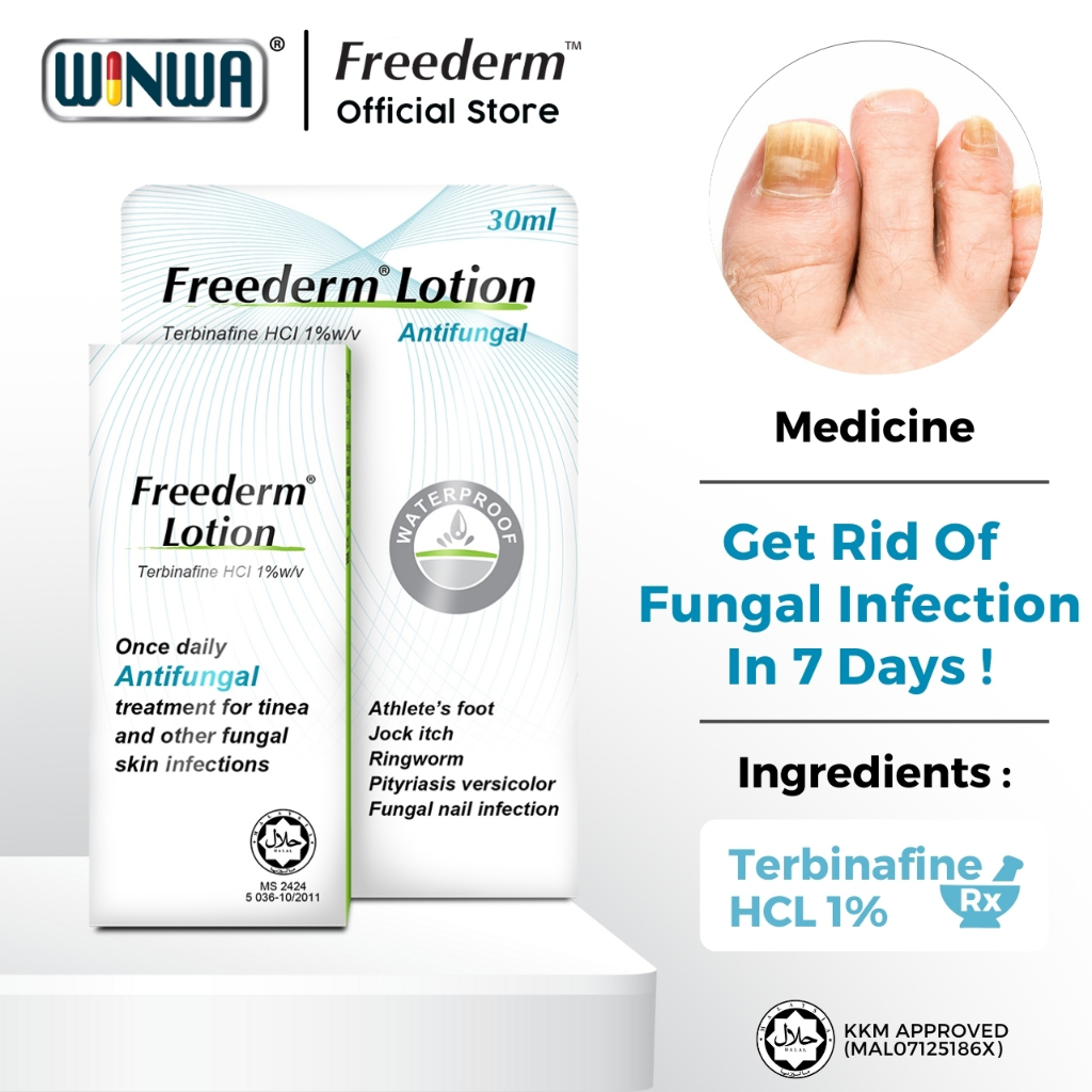 FREEDERM Gel / Lotion - Terbinafine For Athlete Foot & Kurap | Shopee ...