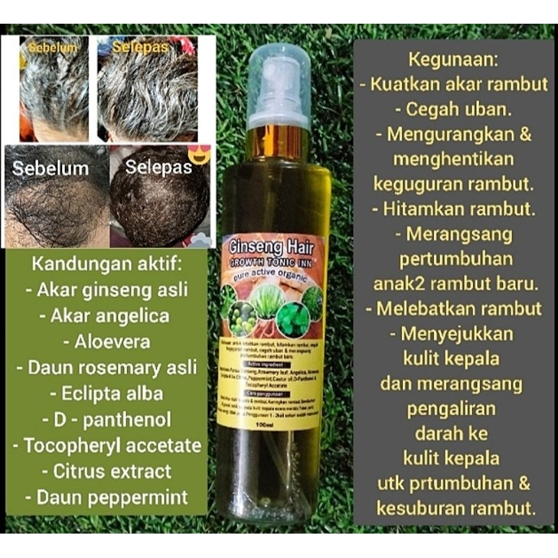 Tonic Lebat Rambut Herba Ginseng inn™ Original inn™ | Shopee Malaysia