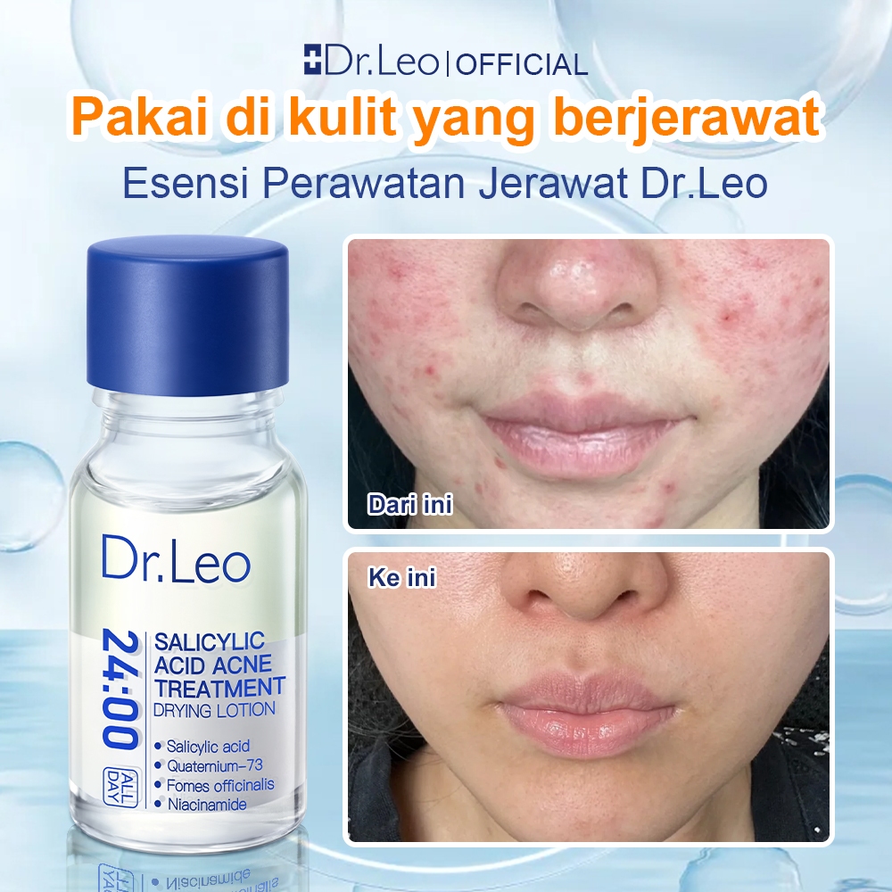 Dr.Leo Acne Essence Salicylic Acid Anti-acne Serum Lighten Acne Scars ...