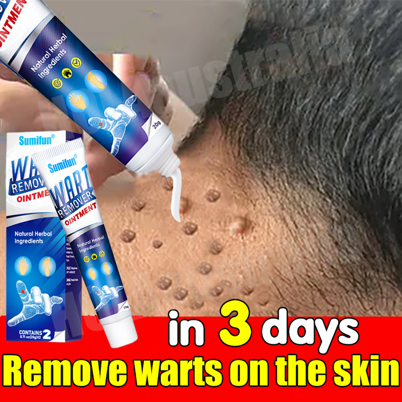 Wart Removal cream ubat kutil Removal tahi lalat remover Warts Remover ...