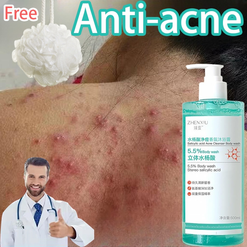 Salicylic acid body wash Acne body wash Sabun badan Antibacterial body wash 500ML Whiteing ...