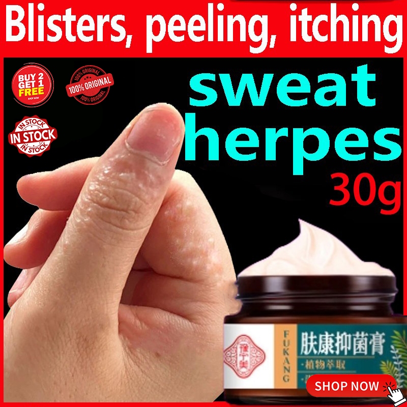 eczema cream obat gatal untuk kulit selangkangan herba cina ubat kurap ...