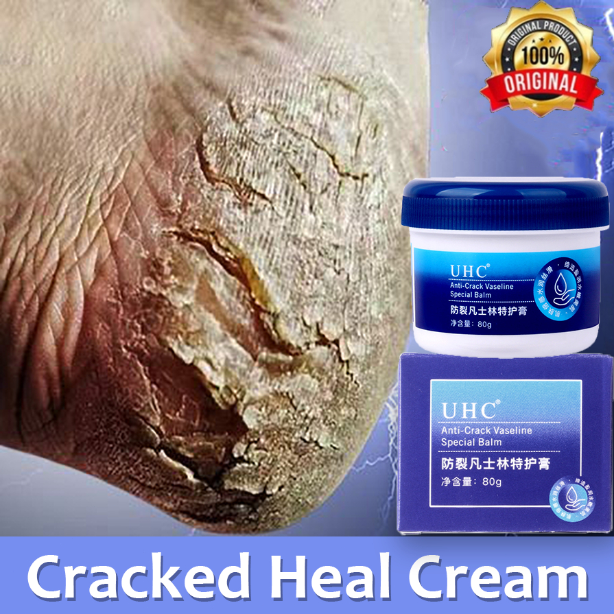 Heel Chapped Heal Cream Cracking Repair Moisturizer 80g Vaseline ...