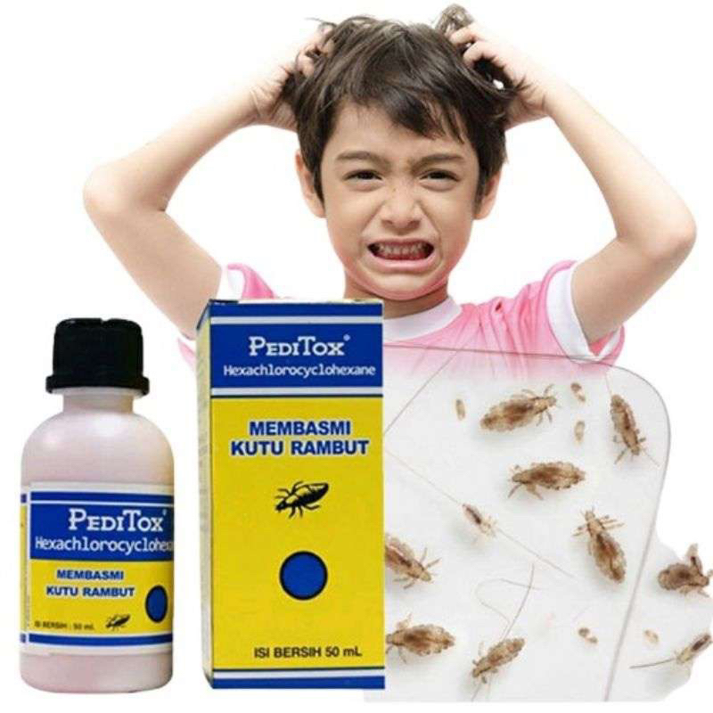 PENGUBATAN KUTU RAMBUT | PEDITOX Permethrin 1% Lotion | Isi : 50 ml ...