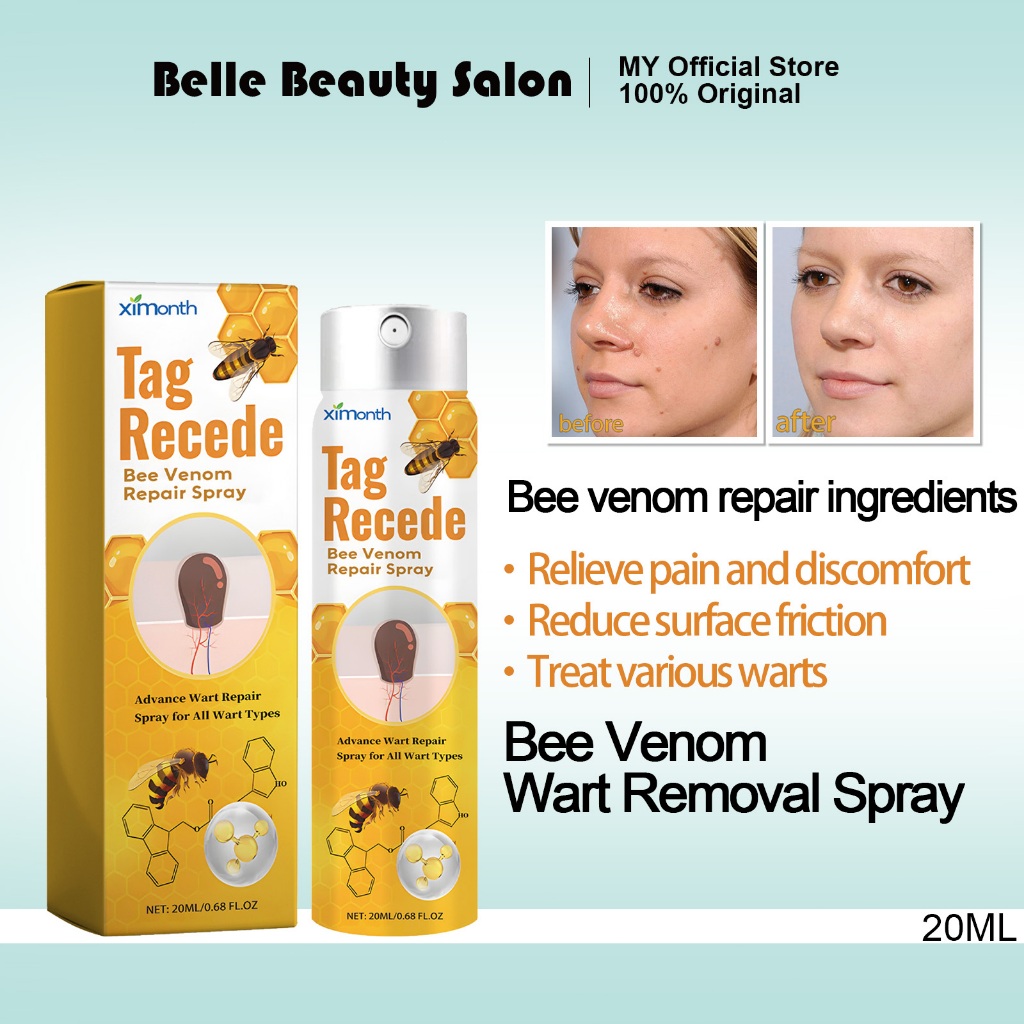 Bee Venom Wart Removal Spray 20ml Tag Recede Wart Mole Ketuat Remover ...