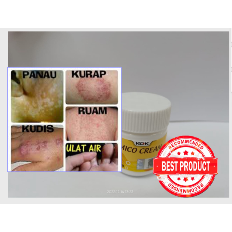 [KURAP] [KRIM] Mecandin ubat panau antifungal brand MICO | Shopee Malaysia
