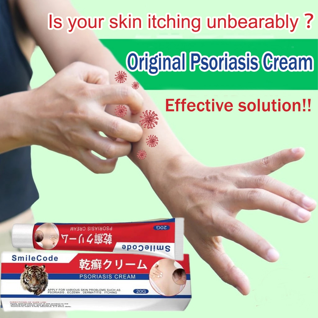 Psoriasis Cream Eczema Ointment Antibacterial Cream ltching Relief 20G ...