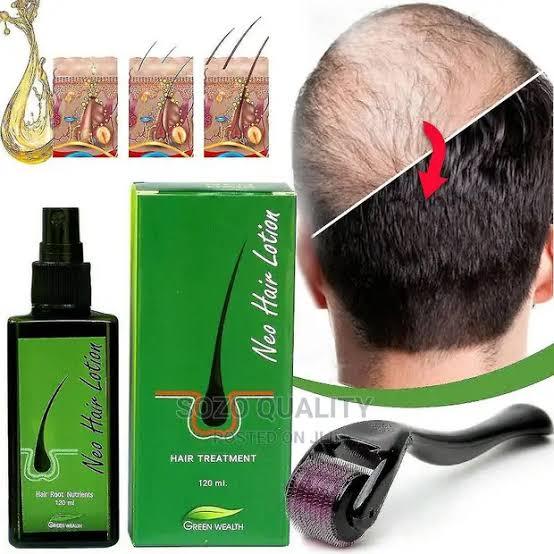 Neo Hair Lotion & 540-Needle Derma Roller 2-in-1 System for Hair ...