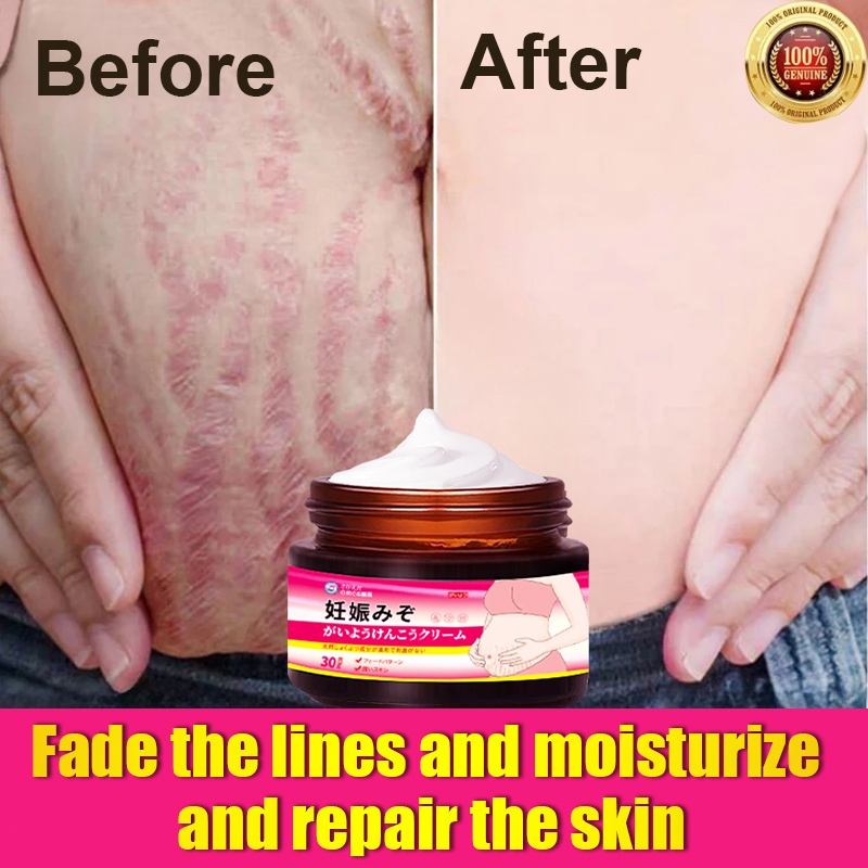 Stretch Mark Cream pregnancy Anti Stretch Mark Cream Maternity Cream ...