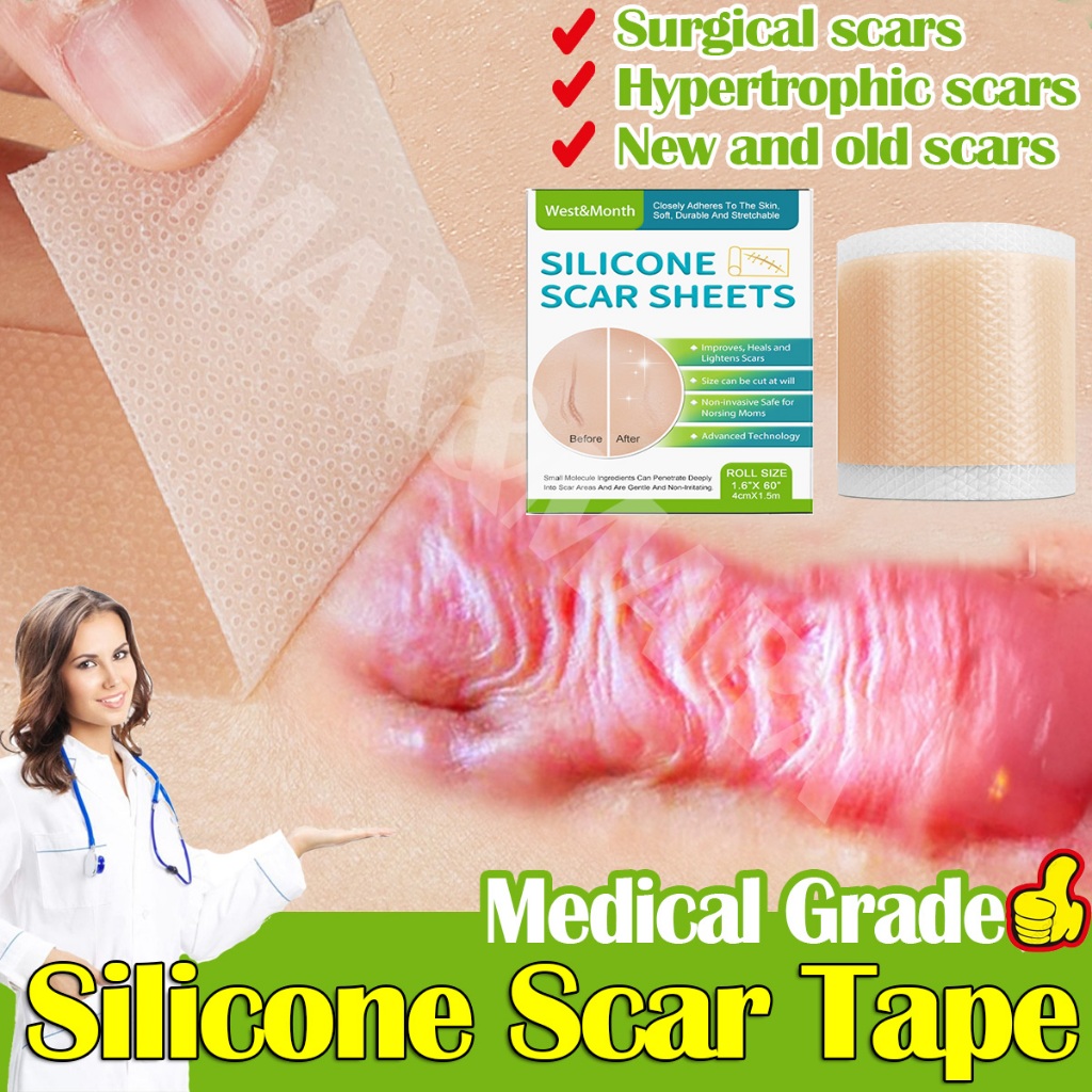 Silicone scar sheets Scar patch scar removal Silicone scar tape keloid ...