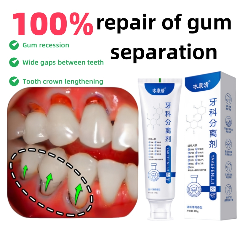gum repair gum instant soothing toothpaste Repair tooth loose gum ...