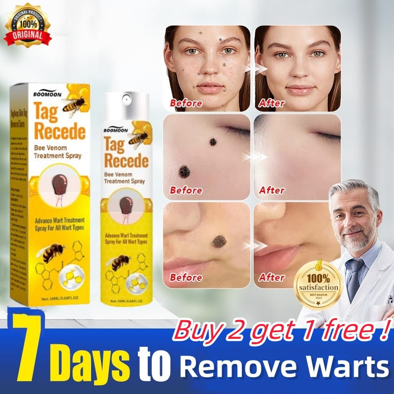 Tag Recede Bee Venom Spary Wart Remover buang tahi lalat Ubat kutil ...