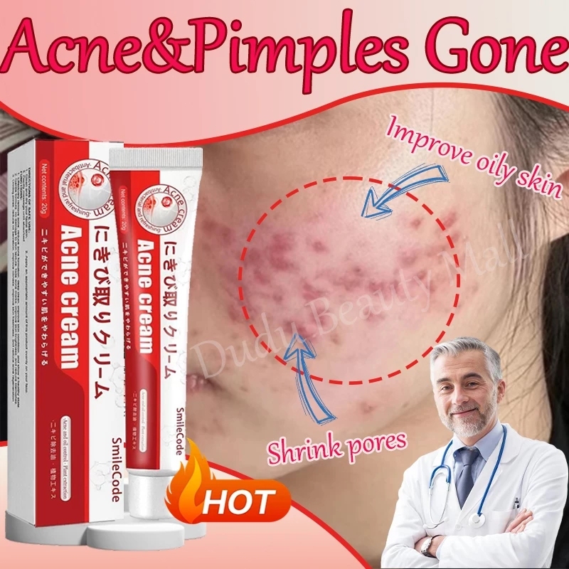 Japanese Acne cream acne spot cream acne scar treatment Shrinking Pores ...