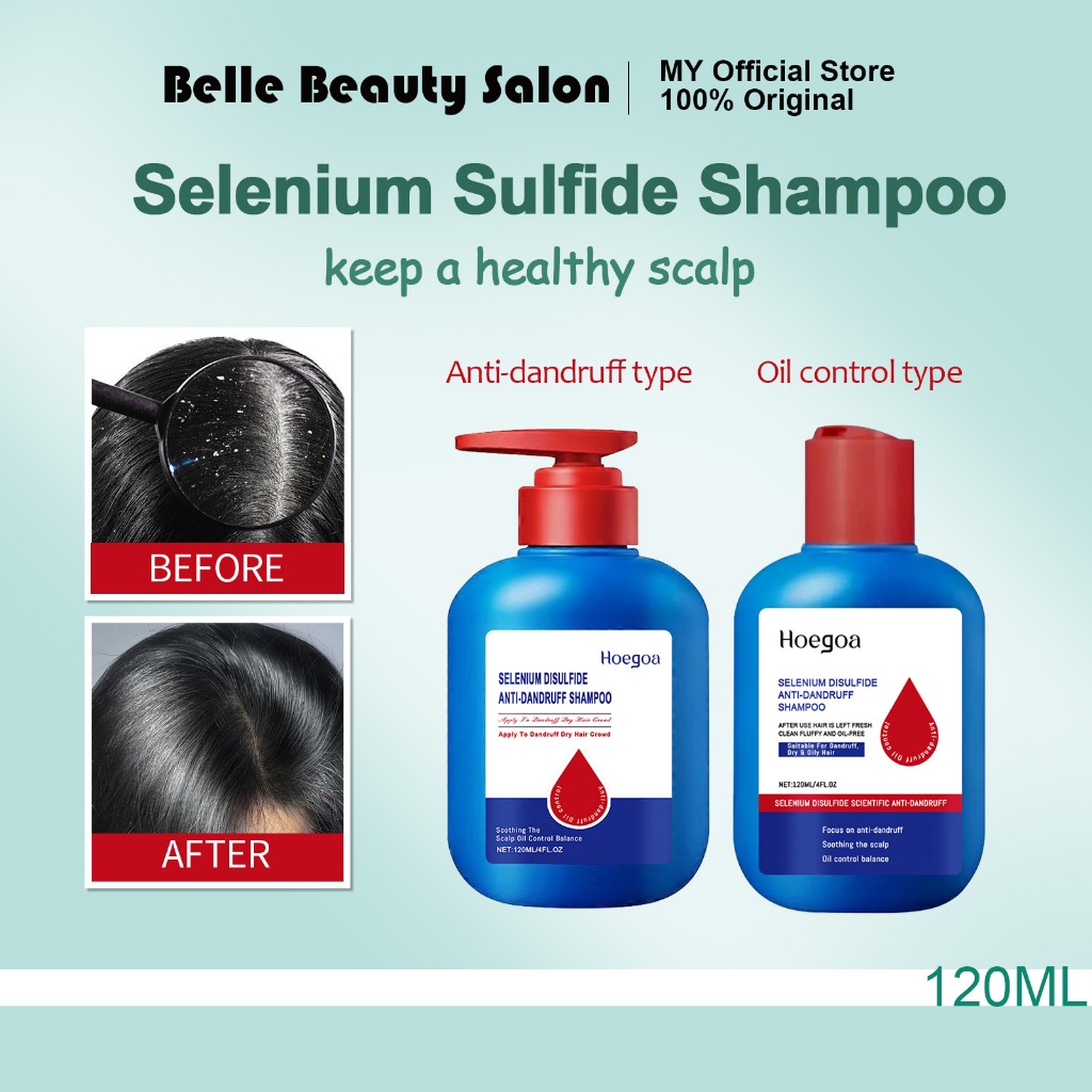 Selenium Sulfide Shampoo 120ml Anti-dandruff +Oil control shampoo ...
