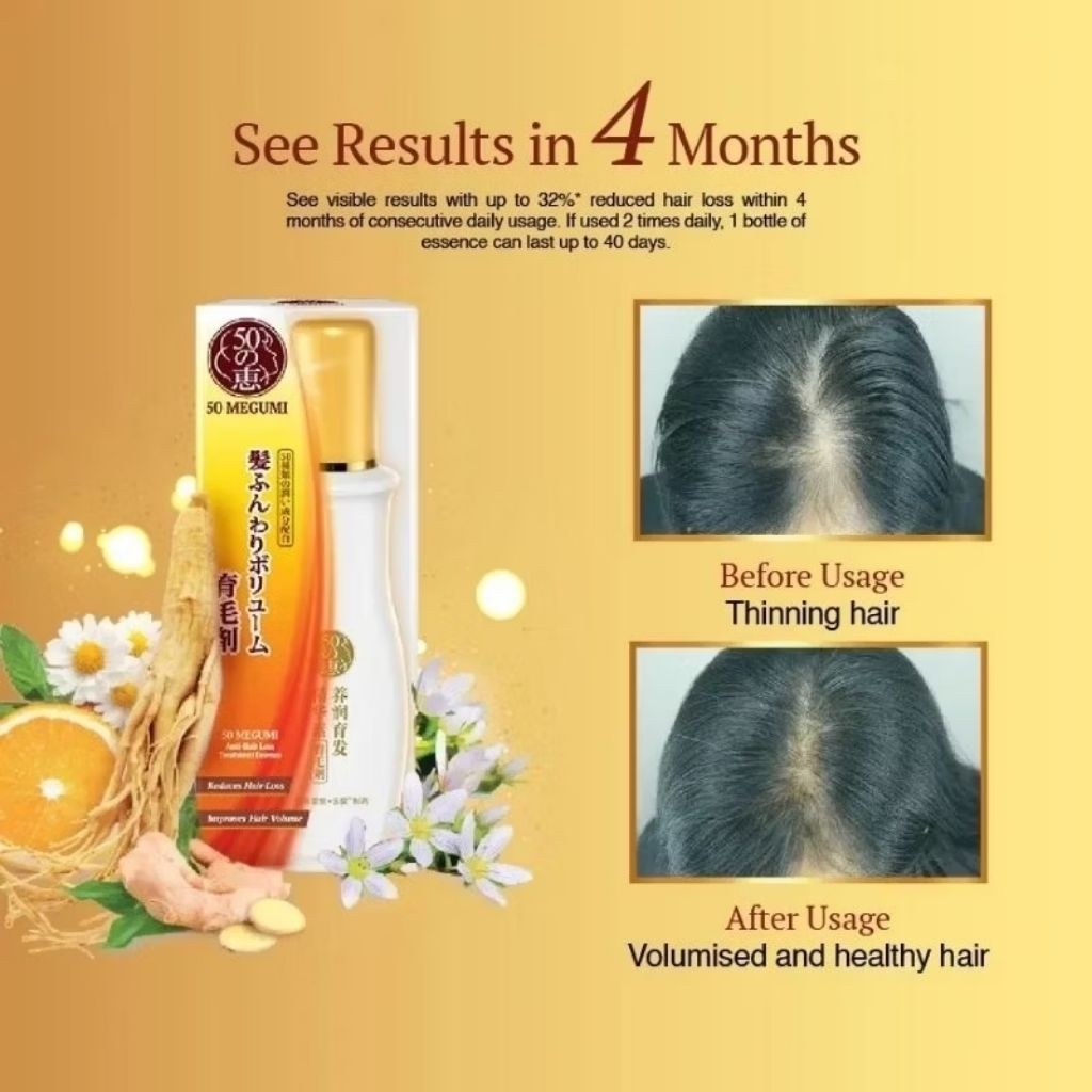 50 Megumi Anti-Hair Loss Treatment Essence (160ml) Ready Stock | Shopee ...