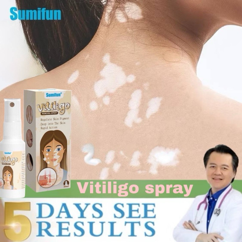 VITILIGO REMOVAL SPRAY Anti vitiligo penghilang panau vitiligo tompok ...