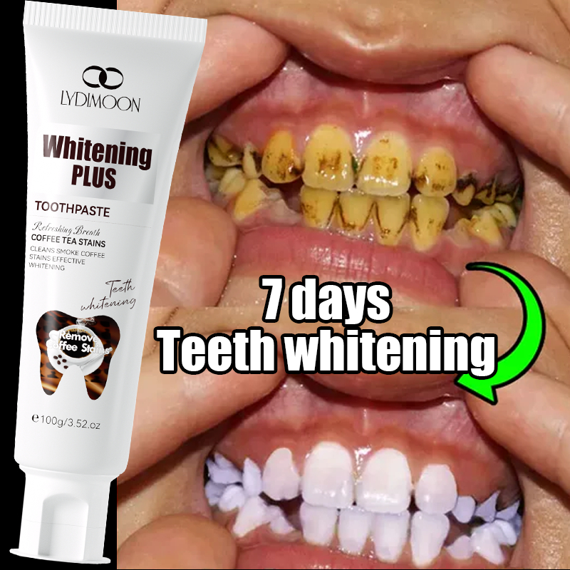 Whitening toothpaste 100g remove yellowing, bad breath, fresh breath ...