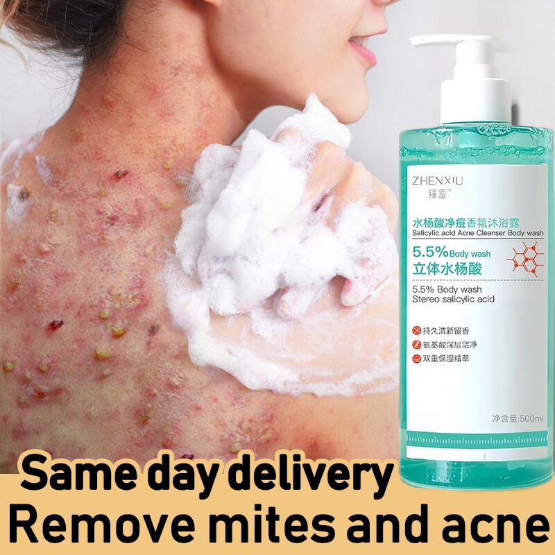 Acne body wash eczema body wash sabun badan Antibacterial body wash whitening shower gel 500ML ...