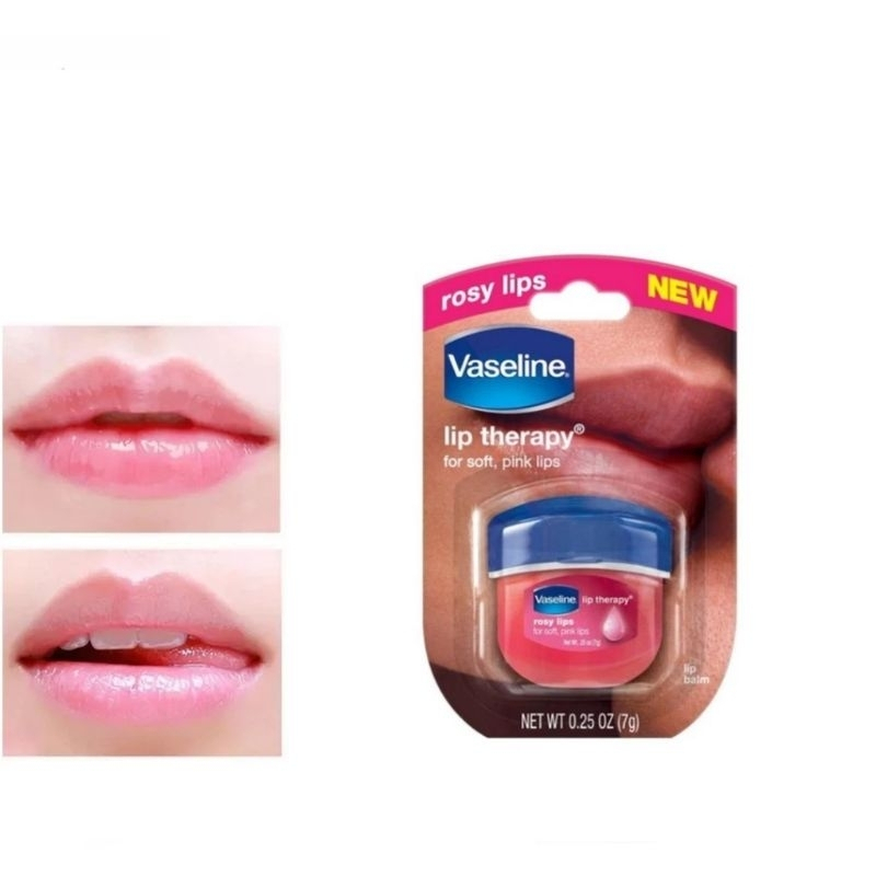 Vaseline Lip Therapy 7g | Shopee Malaysia
