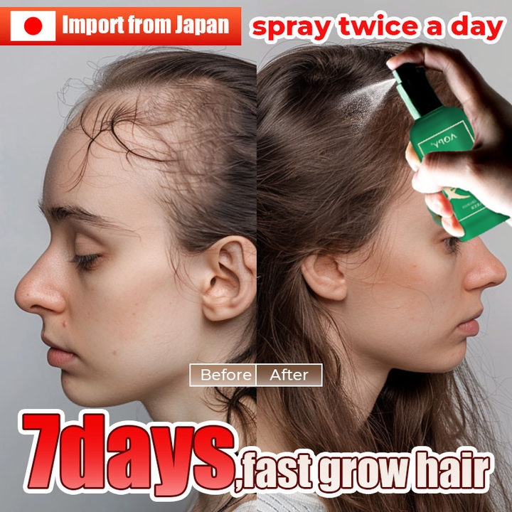 Anti-Gair Loss Hair Tonic Hair Regrowth Spray For Women And Men 30ml ...