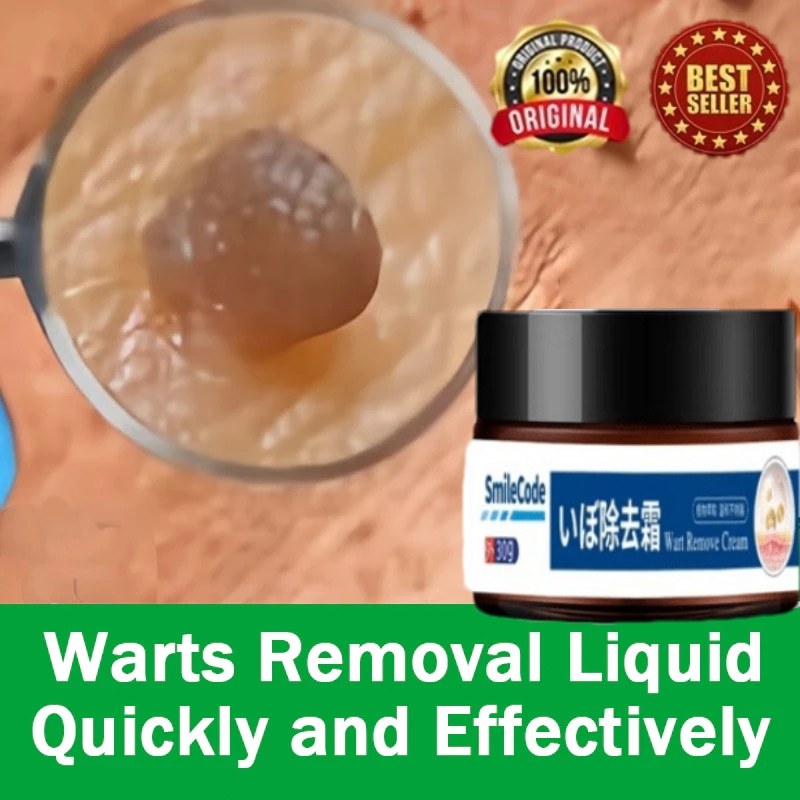 Skin tag remover cream ubat kutil buang tahi lalat warts removal cream ...