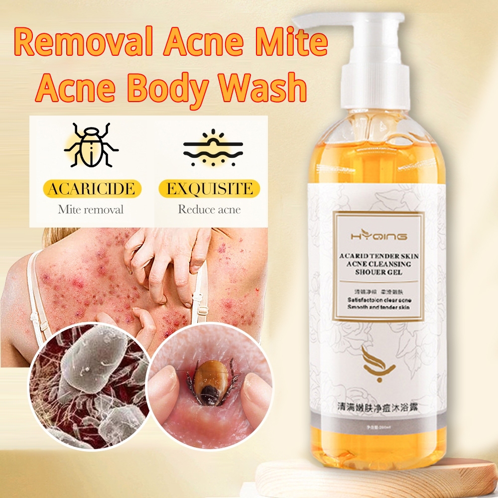 Acne Body Wash Anti Mite sabun jerawat badan Eczema Body Wash 100% herbal Repair Skin Jerawat ...