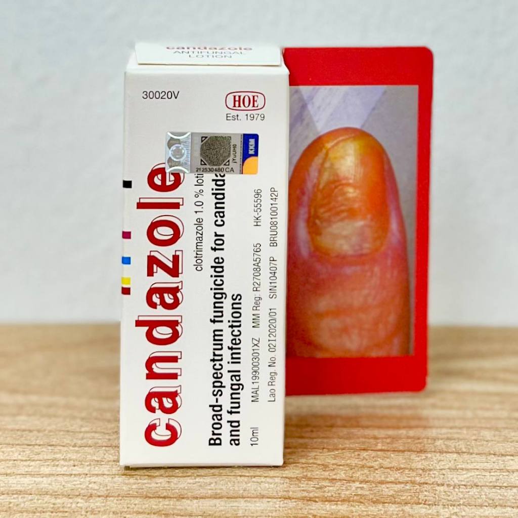 Lulus KKM - Candazole Clotrimazole Lotion for Nail Fungal Infection ...