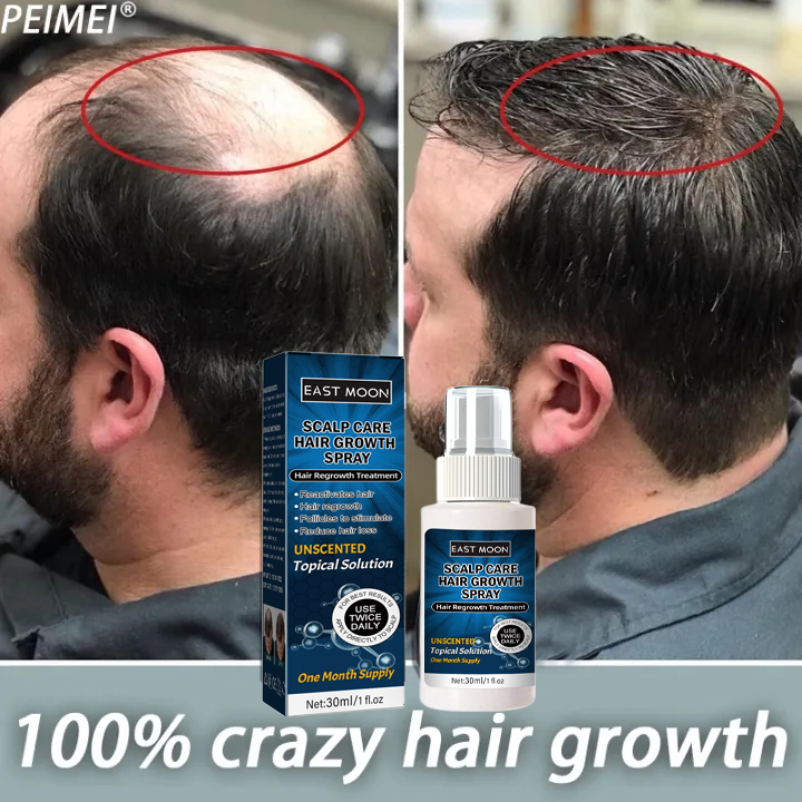 East moon Hair Growth Spray Hair Grower for Man/Woman Hair Growth Hair ...