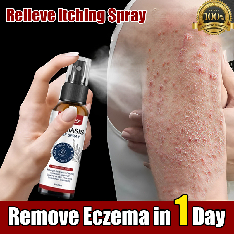 krim gatal ubat gatal kulit psoriasis spray eczema cream Herbal ...