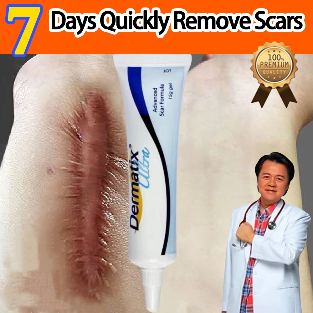 Dermatix Ultra Scar Gel 15g Remove Stretch Marks Whitening Cream ...