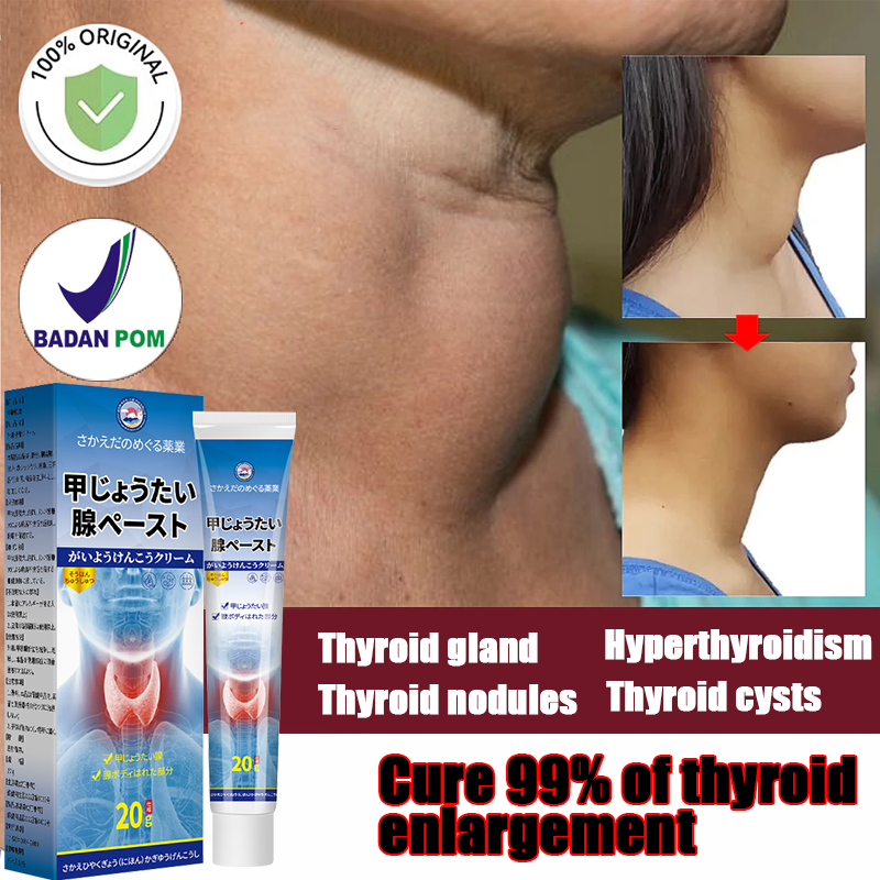 Thyroid Care Ointment Neck Lump Thyroid Cyst Hyperthyroidism 9537