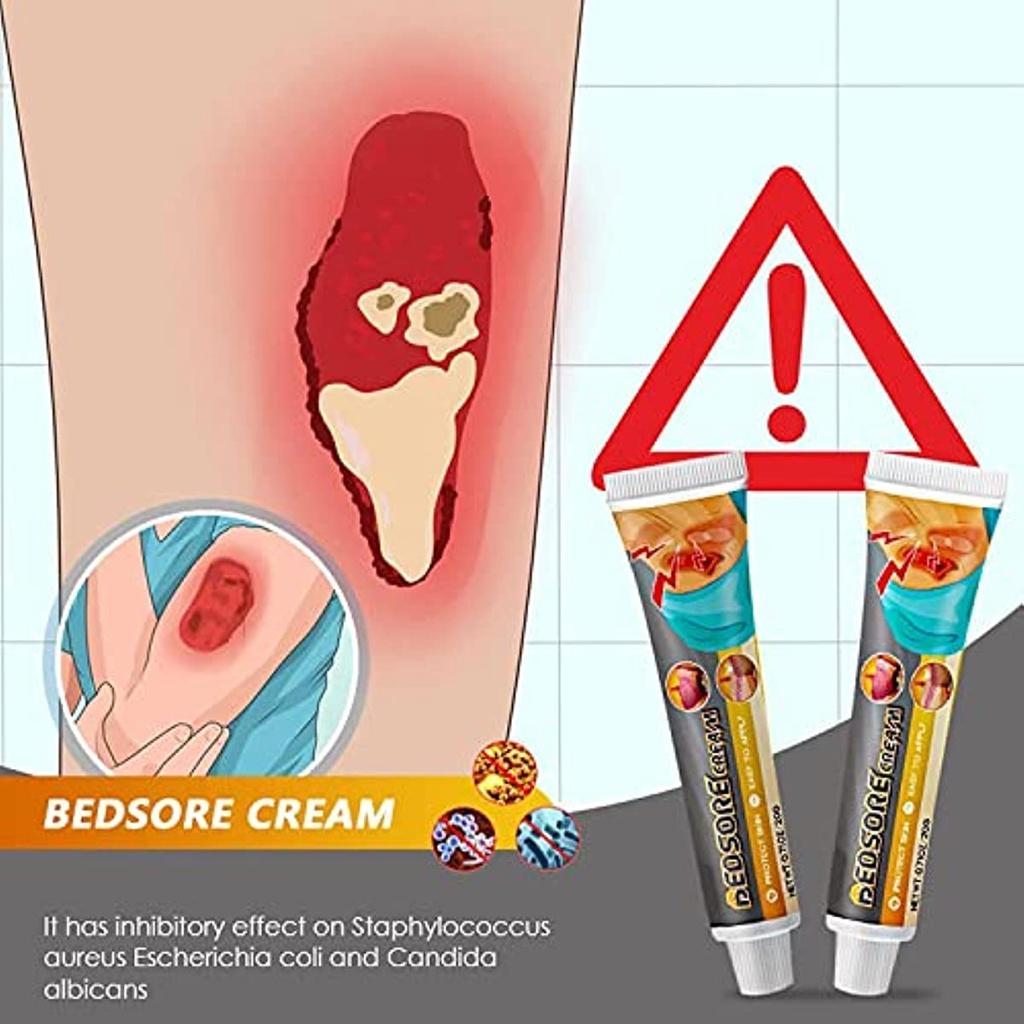 Anti Bedsore Cream Herbal Bedsores Cream Healing Wound Plasters Treat ...